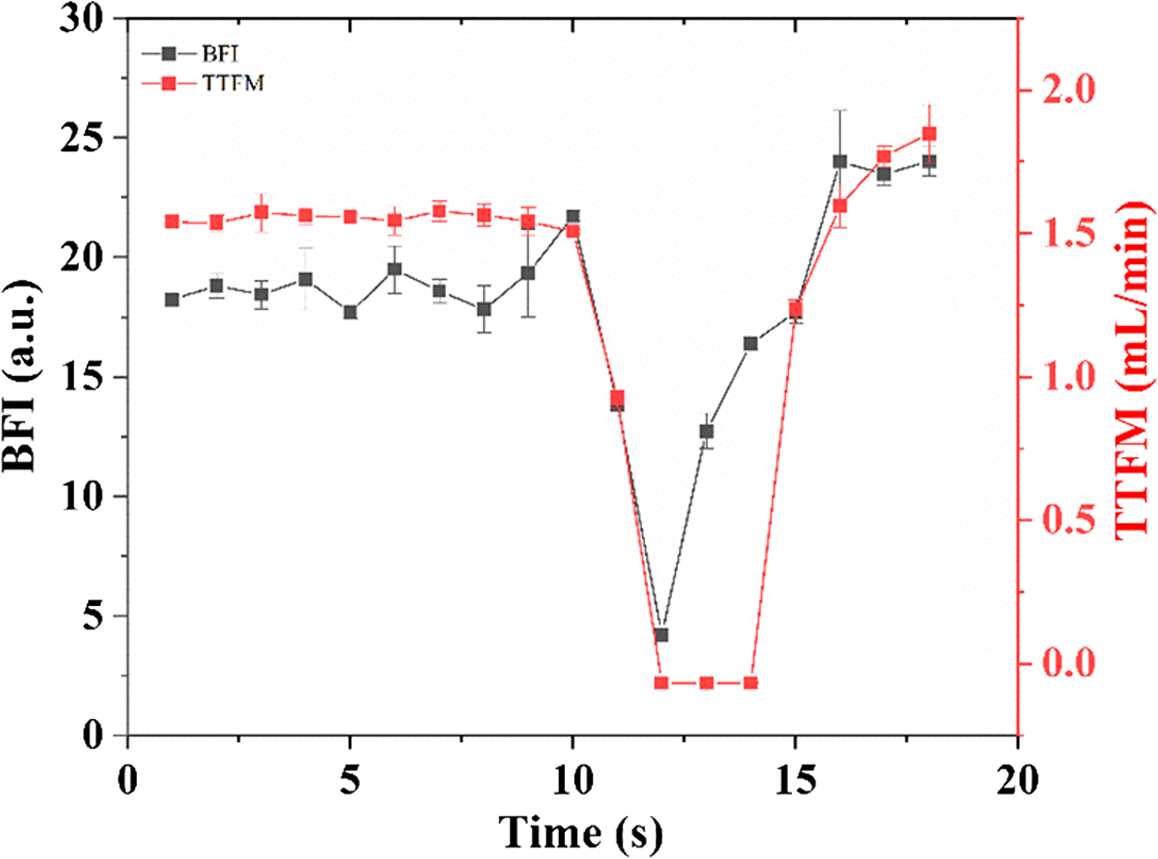 Wide dynamic range measurement of blood flow in vivo using laser ...